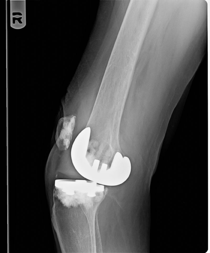 Implant Identification - orthopaediclist.com Implant Identification - orthopaediclist.com