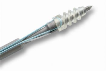 Suture Anchors: Absorbable - orthopaediclist.com