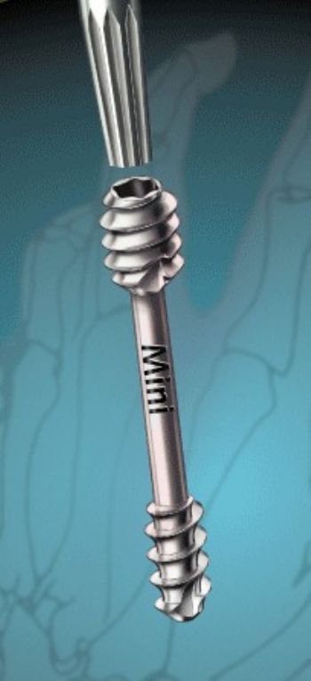 Headless Bone Screw Mini (Prod 4980) - orthopaediclist.com