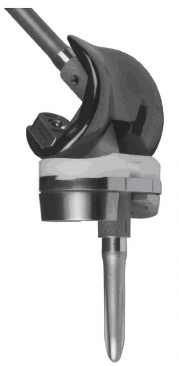 Total Knee, Revision - orthopaediclist.com