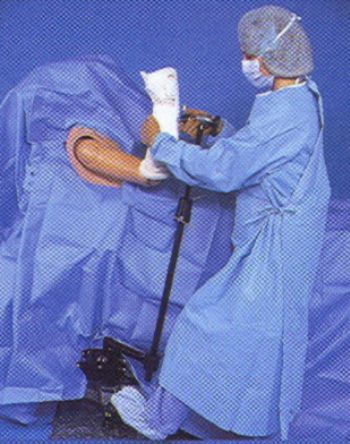 Positioners, Shoulder Surgery - orthopaediclist.com