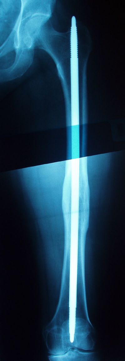 Product Showcase - orthopaediclist.com