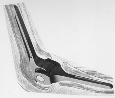 Implant Identification - orthopaediclist.com