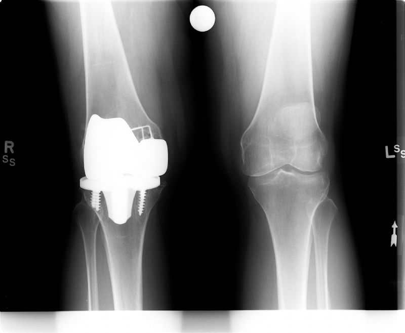 Search by Manufacturer - orthopaediclist.com