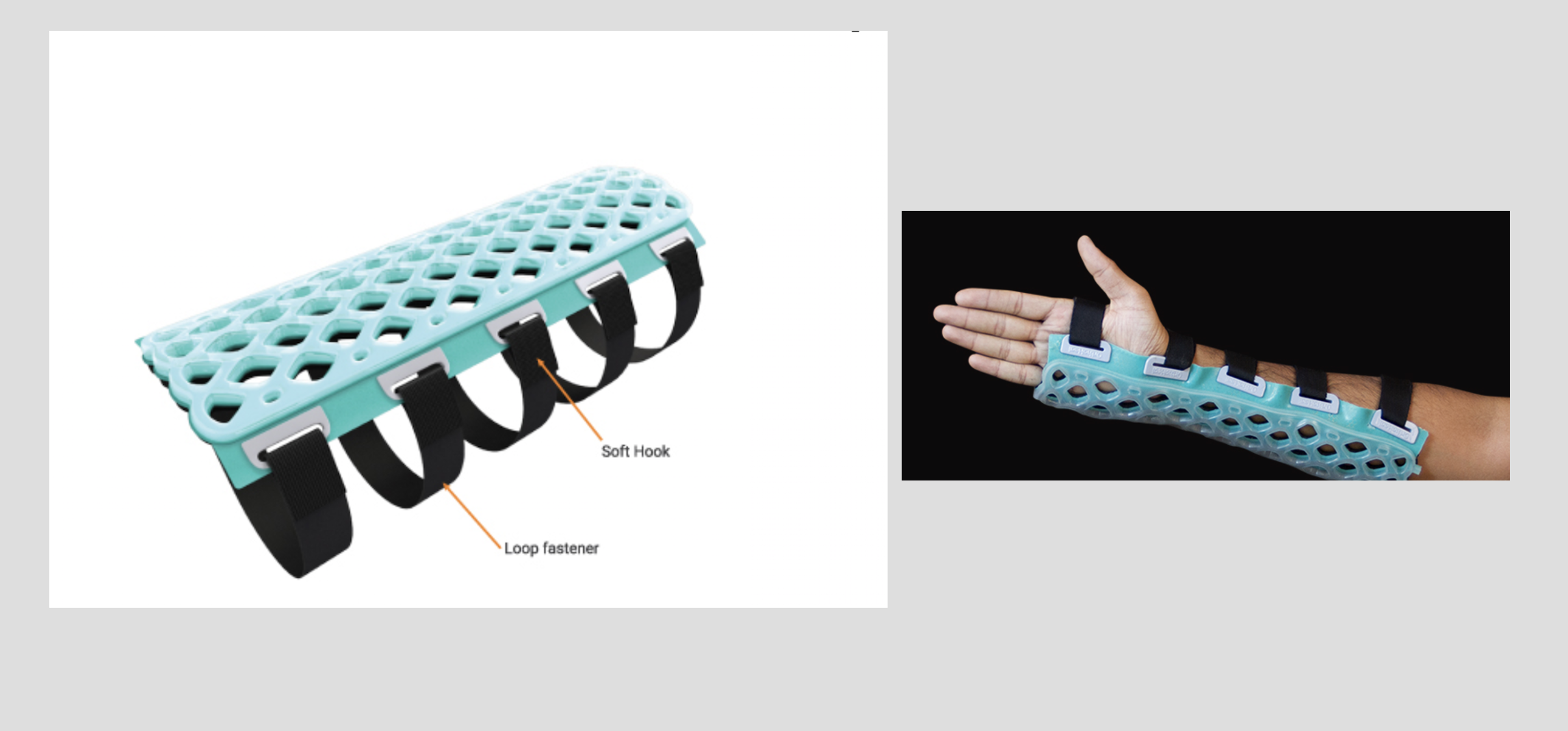 FlexiOH® Splint or Slab (Prod 2006082) - orthopaediclist.com